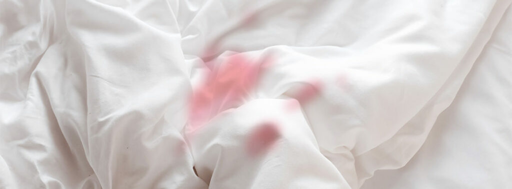 How To Get Blood Out Of Sheets